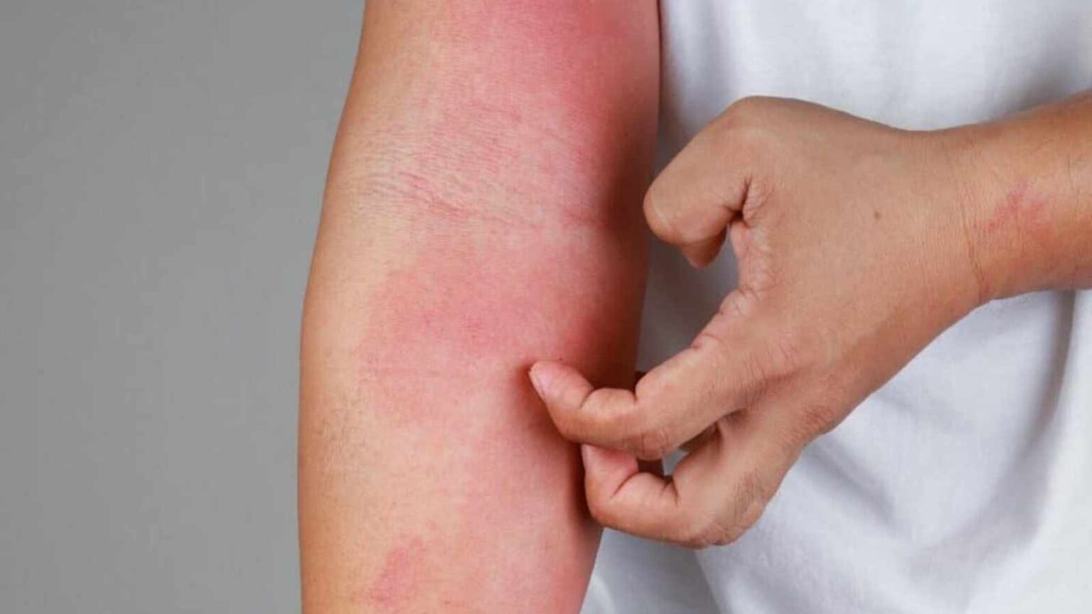 The 10 Common Skin Rashes and How to Get Rid of Them - Health Makes You